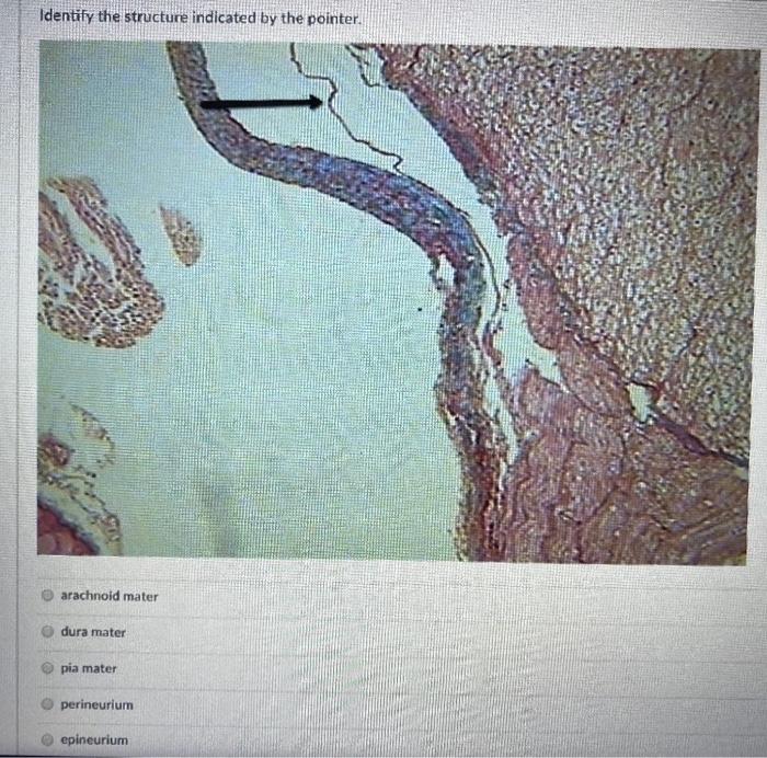 Solved Identify the structure indicated by the pointer. | Chegg.com