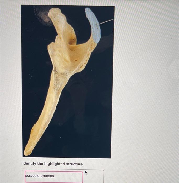 Solved Identify the highlighted structure. coracoid process | Chegg.com