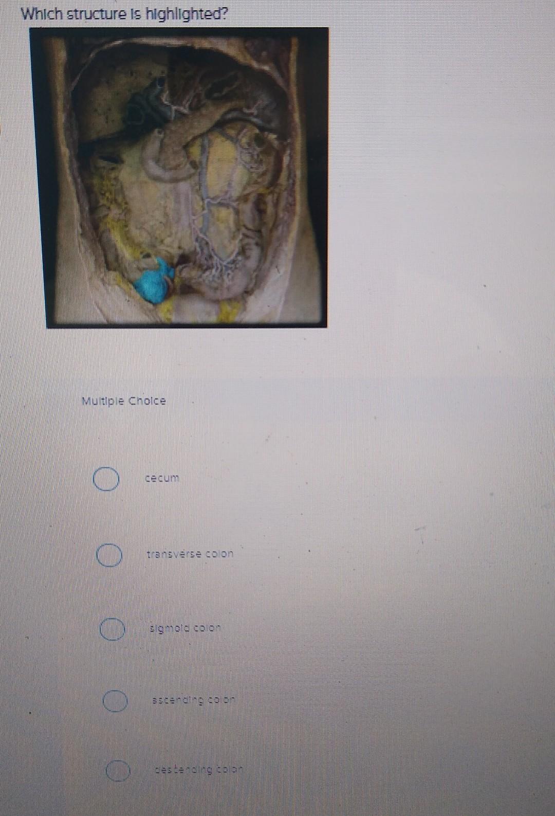 Solved Which structure is highlighted? Mutiple Cholce cecum | Chegg.com