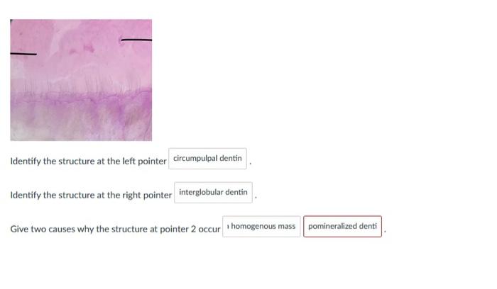Solved Identify the structure at the left pointer | Chegg.com