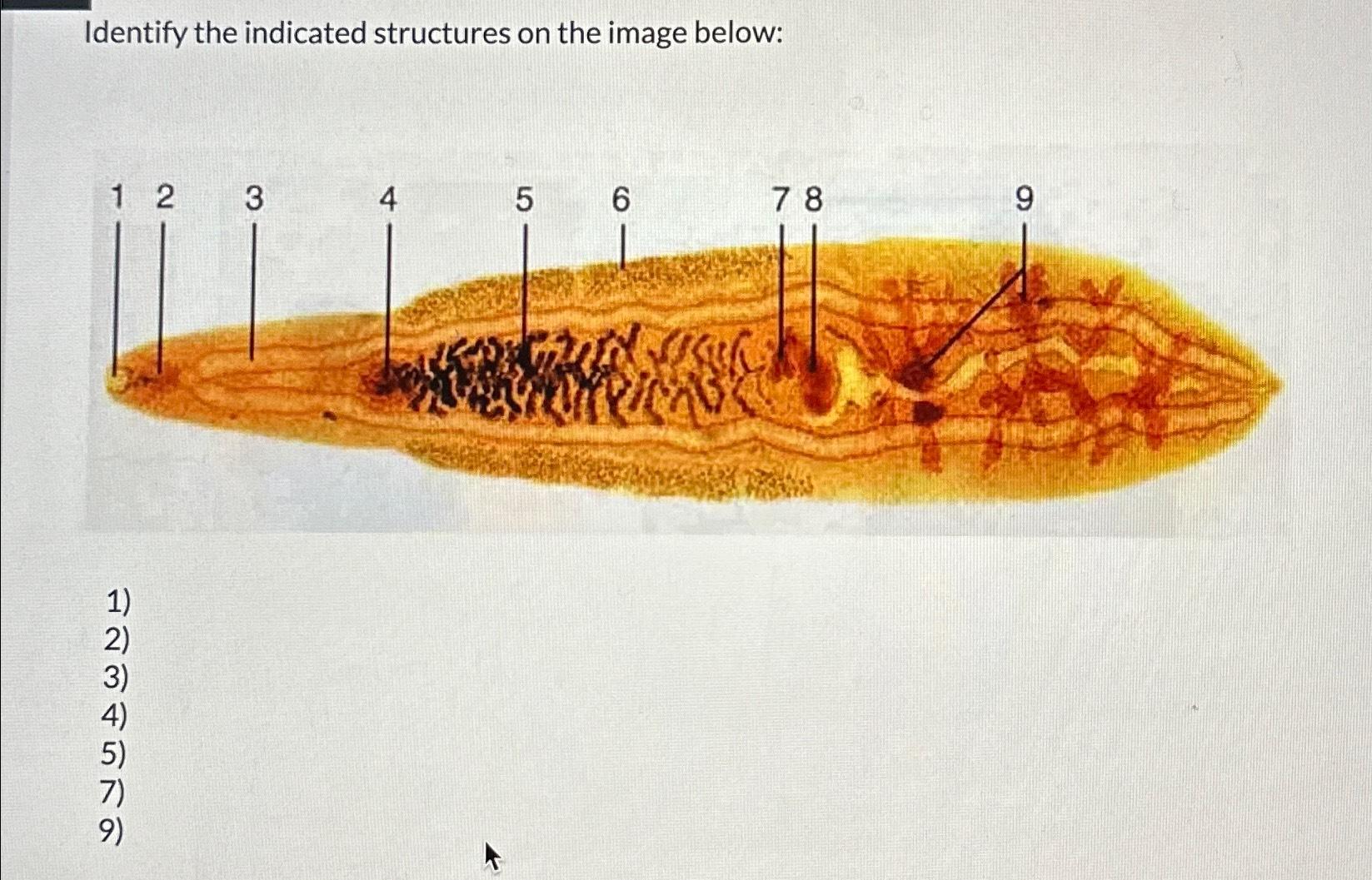 Solved Identify the indicated structures on the image | Chegg.com