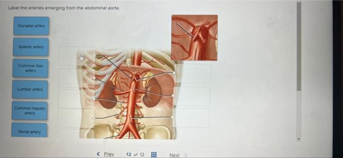 Lumbar Arteries From Abdominal Aorta