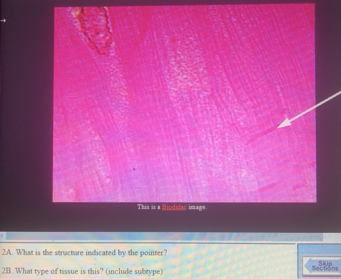 Solved This is a Biodidac image. 2A. What is the structure | Chegg.com