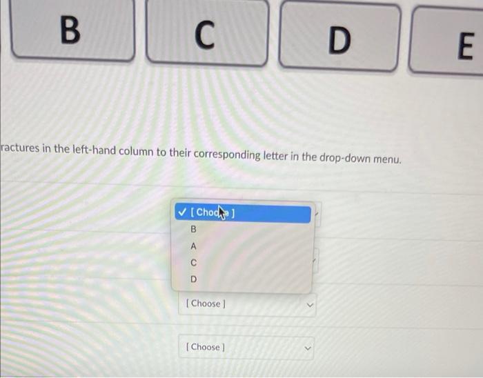 Solved Match the type of bone fractures in the left-hand | Chegg.com
