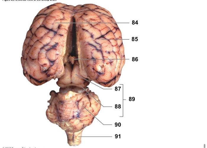 Solved Identify the structures labeled | Chegg.com Solved Identify the structures labeled | Chegg.com