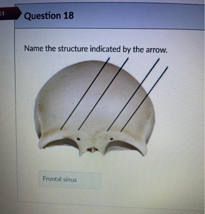 Solved Name the structure indicated by the arrow. | Chegg.com