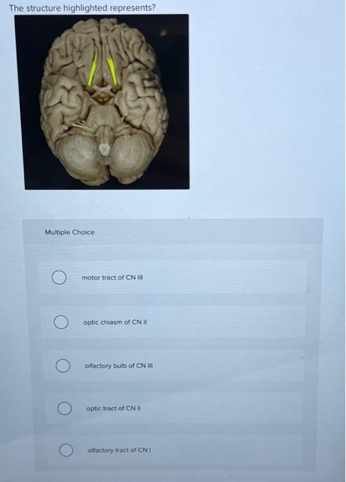 Solved The structure highlighted represents? Multiple Choice | Chegg.com