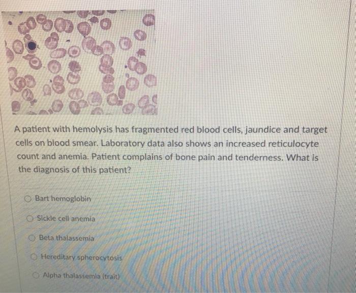 Solved A patient with hemolysis has fragmented red blood | Chegg.com