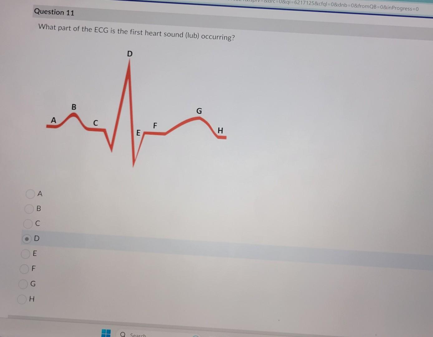 What part of the ECG is the first heart sound (lub) | Chegg.com