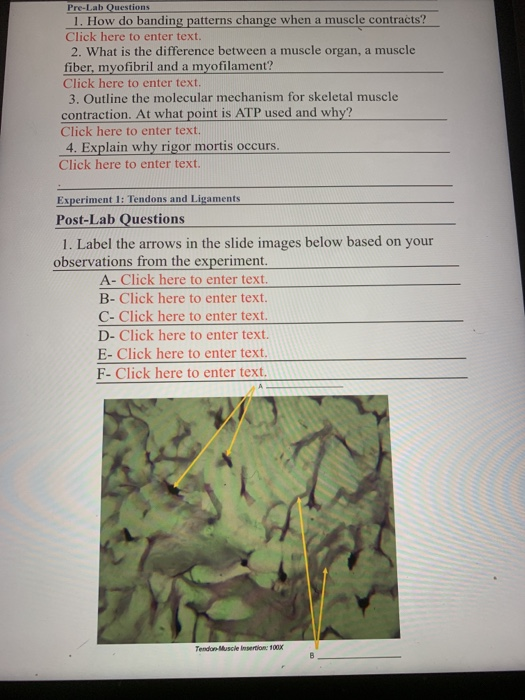 Solved Pre-Lab Questions 1. How do banding patterns change | Chegg.com