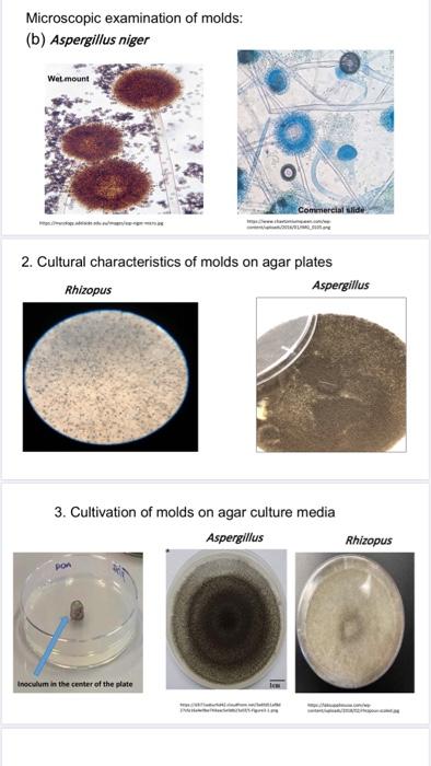 Solved Yeast Morphology and cultural characteristics c. | Chegg.com