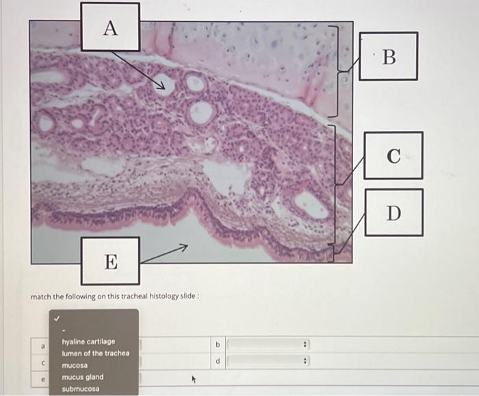 Solved match the following on this tracheal histology slide | Chegg.com