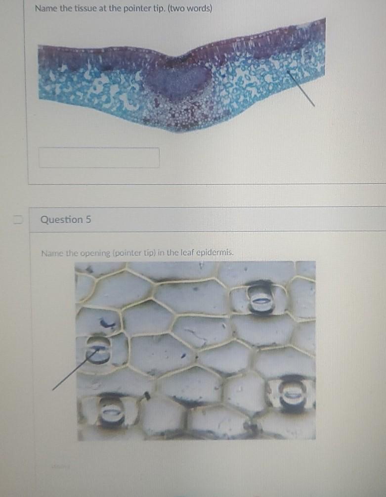 Solved Name the tissue at the pointer tip. (two words) | Chegg.com