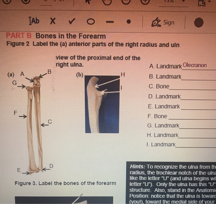 Solved [Ab X Sign PART B Bones in the Forearm Figure 2 | Chegg.com