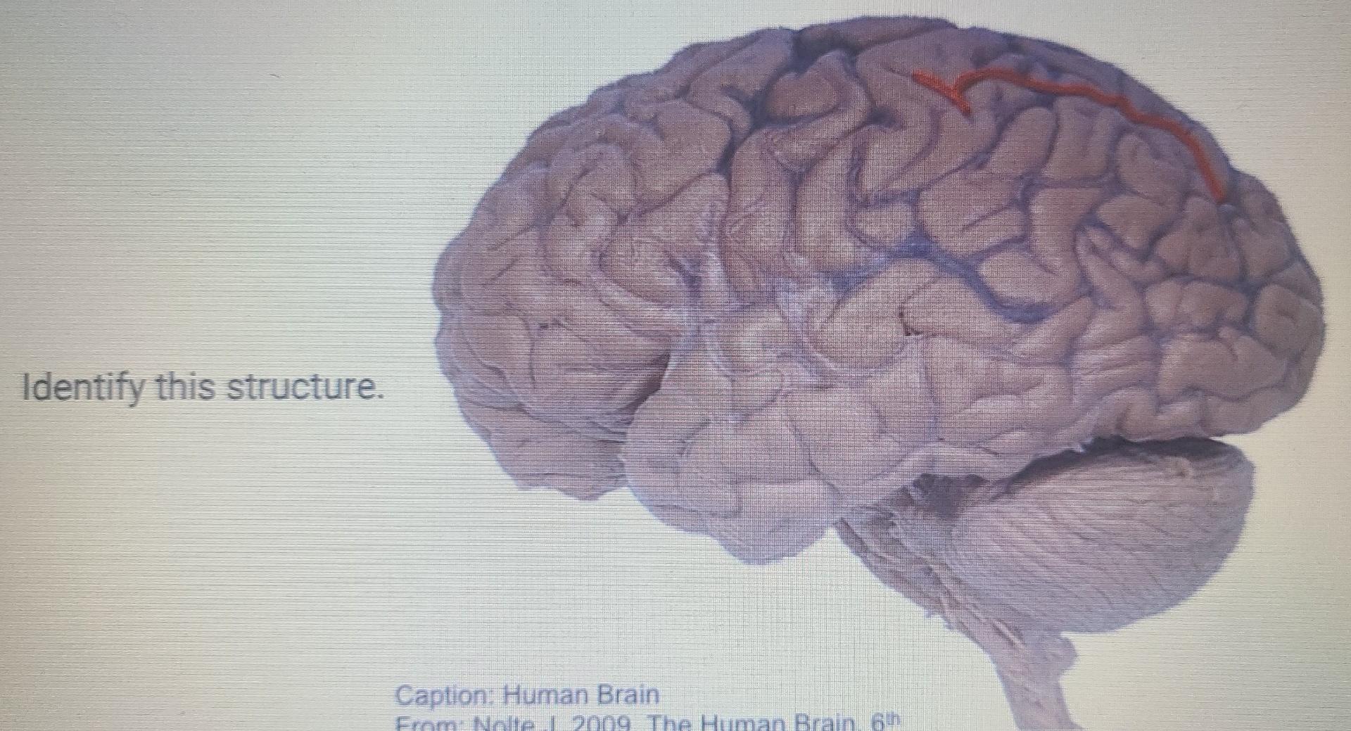 Solved Identify this structure. Caption: Human Brain From | Chegg.com