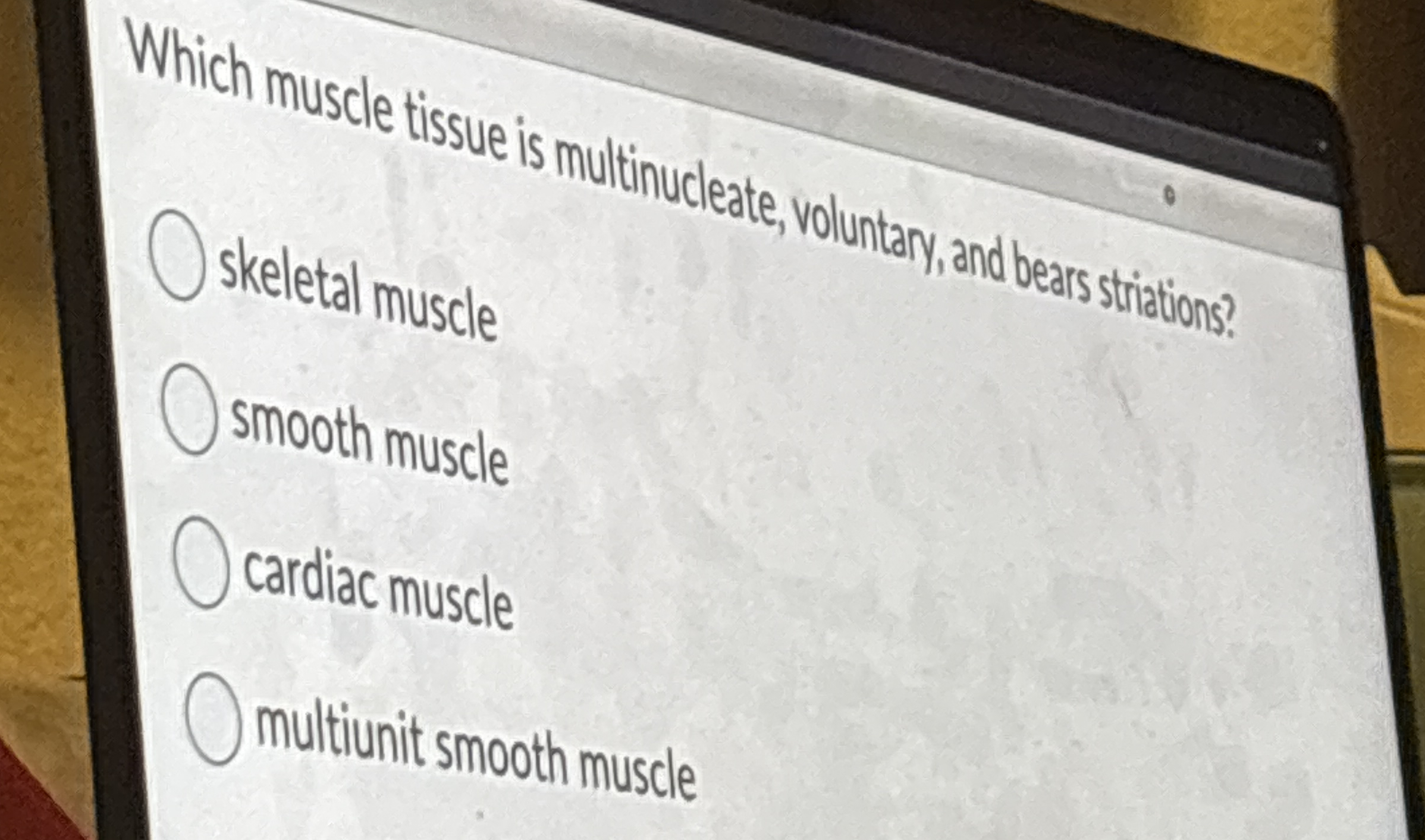 Solved Which muscle tissue is multinucleate, voluntany, and | Chegg.com