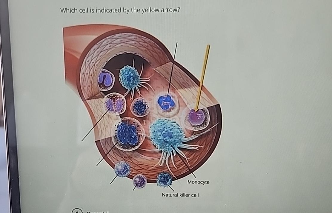Solved Which cell is indicated by the yellow arrow? | Chegg.com