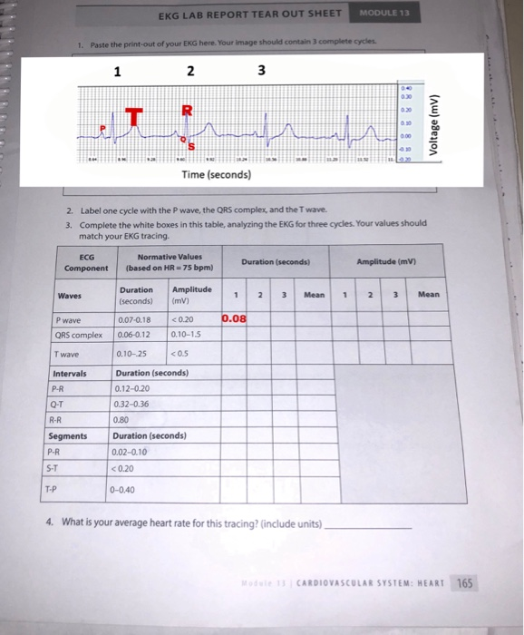 EKG LAB REPORT TEAR OUT SHEET MODULE 13 1. Paste the | Chegg.com