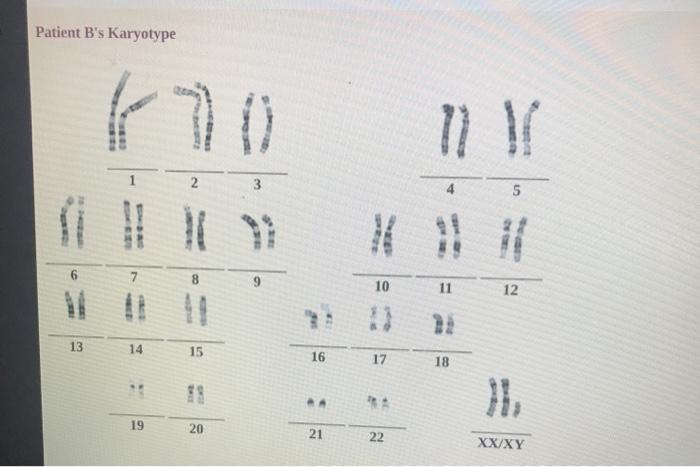 Solved Interpreting the karyotype Lab technicians compile | Chegg.com