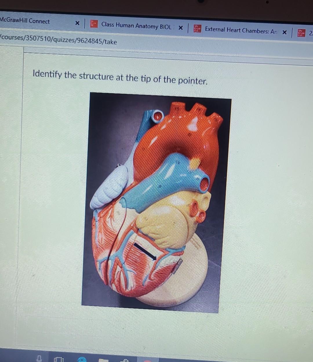 Solved Identify the part of the conducting system at the tip | Chegg.com