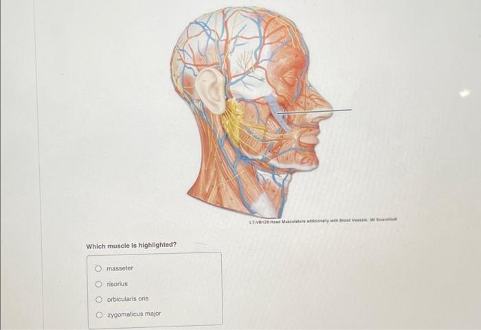 Solved Which muscle is highlighted? masseter Orisorius | Chegg.com