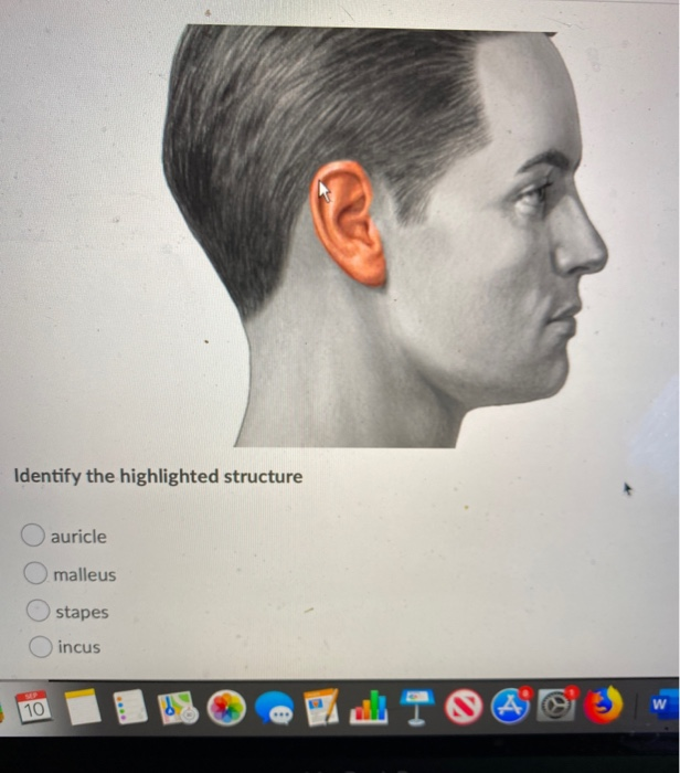 Solved Identify the highlighted structure auricle malleus | Chegg.com