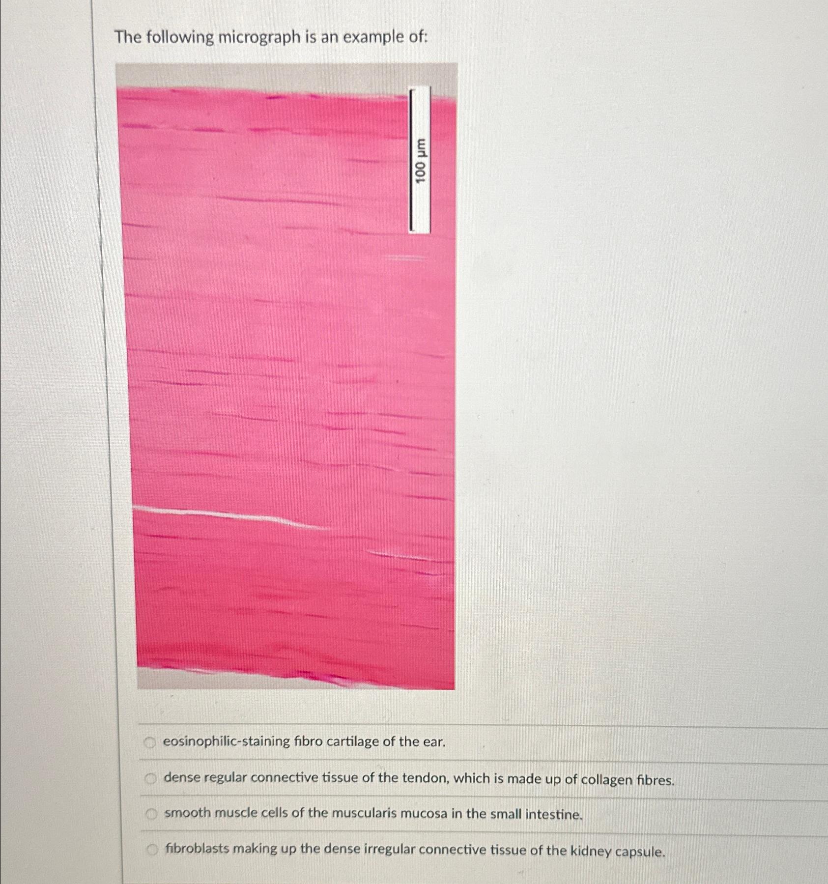 Solved The following micrograph is an example | Chegg.com