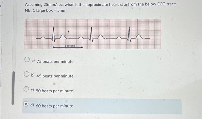 Solved Assuming 25 mm/sec, what is the approximate heart | Chegg.com