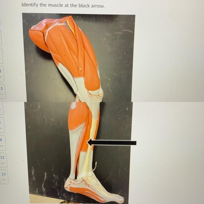Solved Identify the muscle at the black arrow. 2 -5 -9 12 15 | Chegg.com