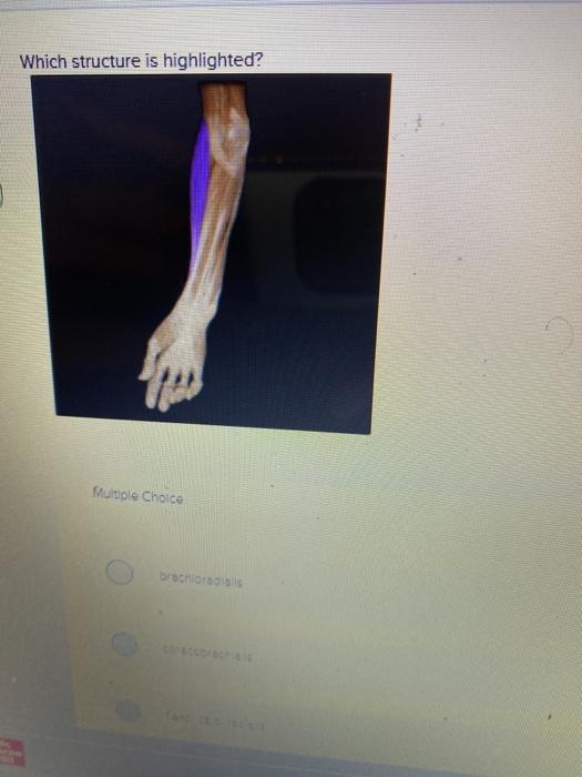 Solved Which structure is highlighted? Multiple Choice | Chegg.com