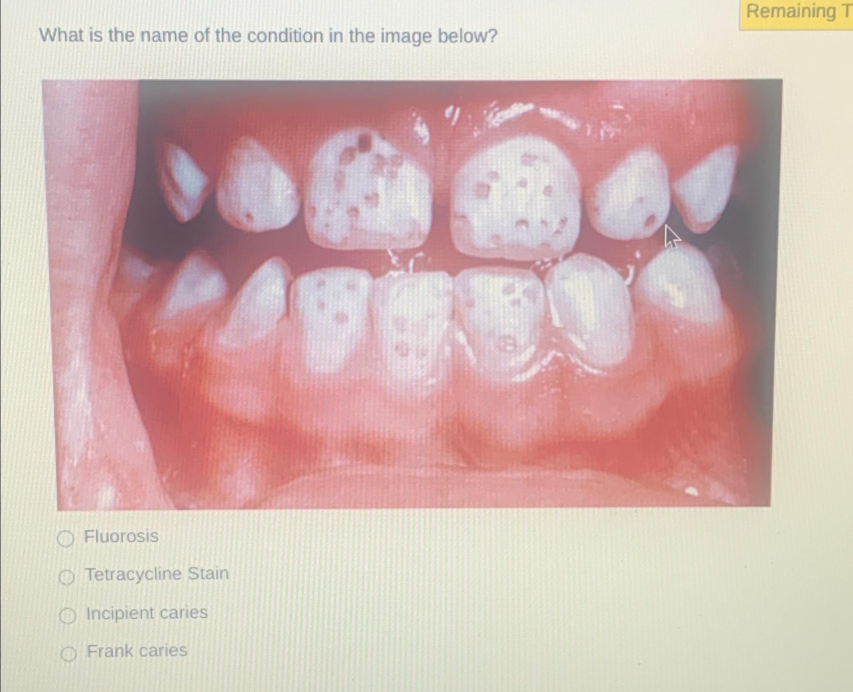 Solved Remaining TWhat is the name of the condition in the | Chegg.com