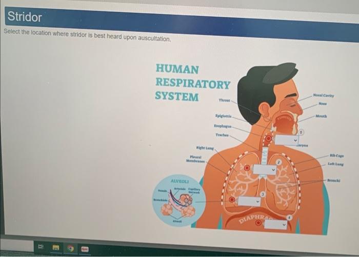 Solved Stridor Select the location where stridor is best | Chegg.com