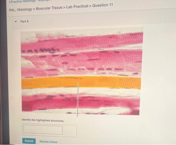 Solved Identify the highlighted structures. Identify the | Chegg.com Solved Identify the highlighted structures. Identify the | Chegg.com
