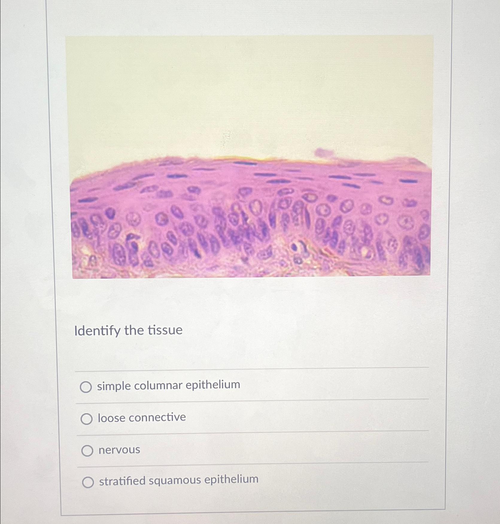 Solved Identify the tissuesimple columnar epitheliumloose | Chegg.com