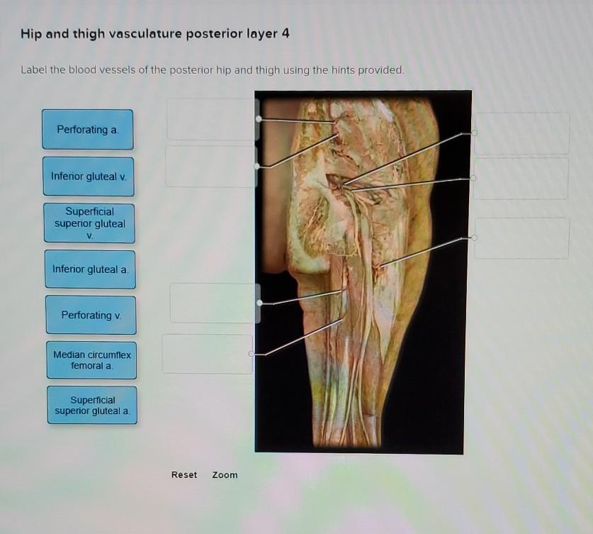 Solved Hip and thigh vasculature posterior layer 4 Label the | Chegg.com