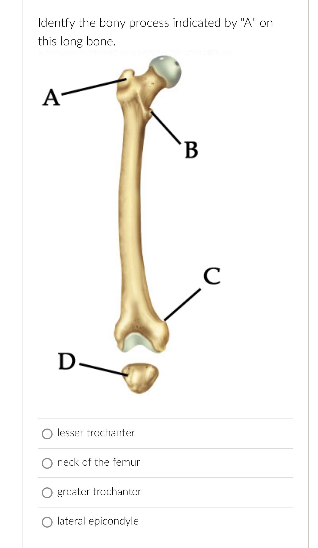Identfy the bony process indicated by "A" ﻿on this | Chegg.com