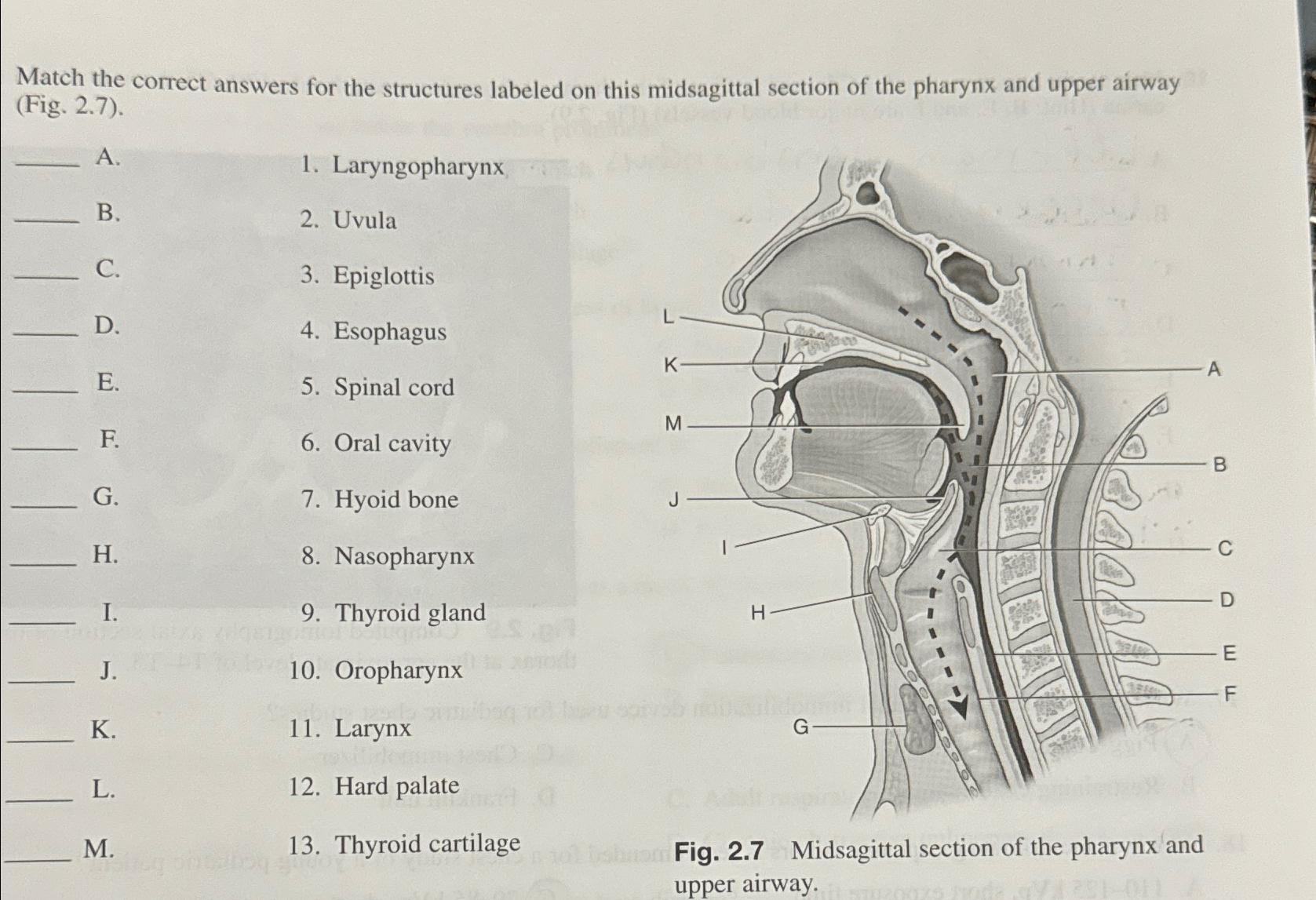 Solved Match the correct answers for the structures labeled | Chegg.com