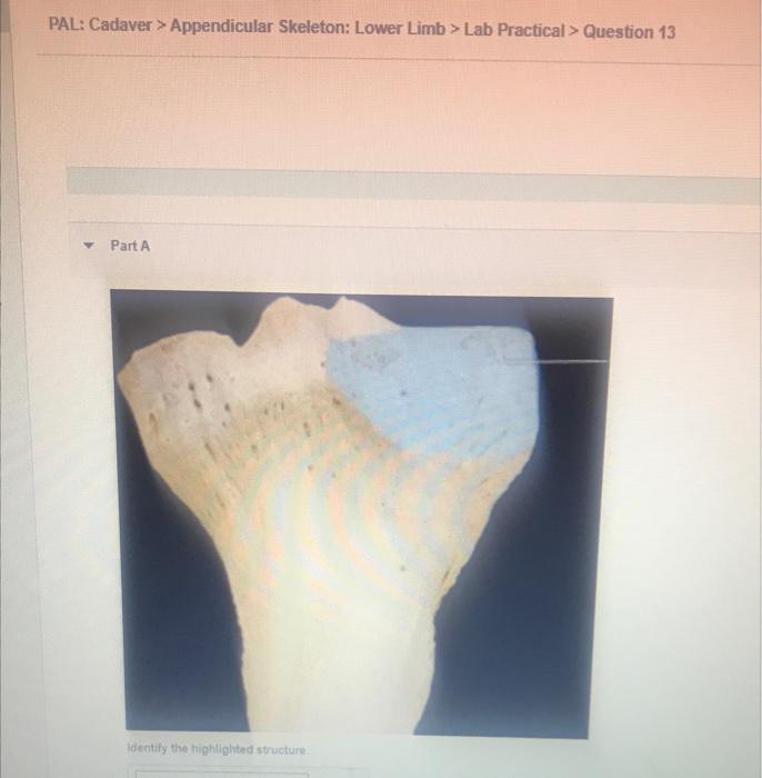 Solved PAL: Cadaver > Appendicular Skeleton: Lower Limb> Lab | Chegg.com Solved PAL: Cadaver > Appendicular Skeleton: Lower Limb> Lab | Chegg.com
