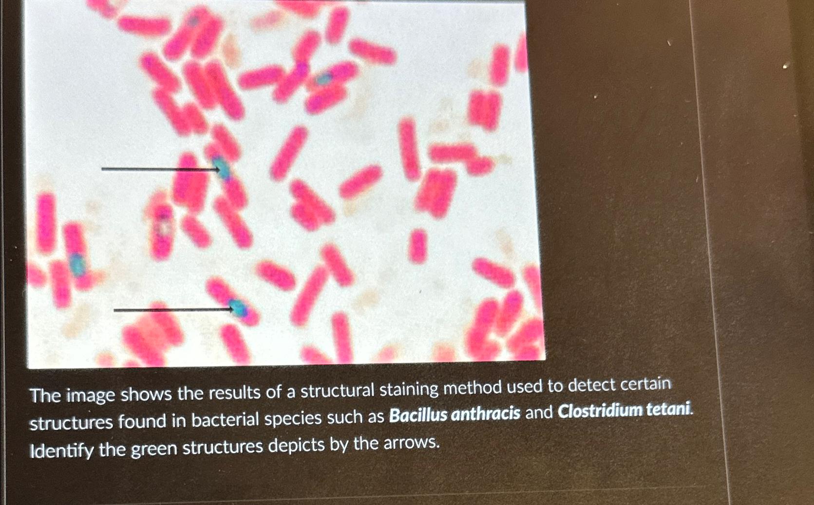Solved The image shows the results of a structural staining | Chegg.com