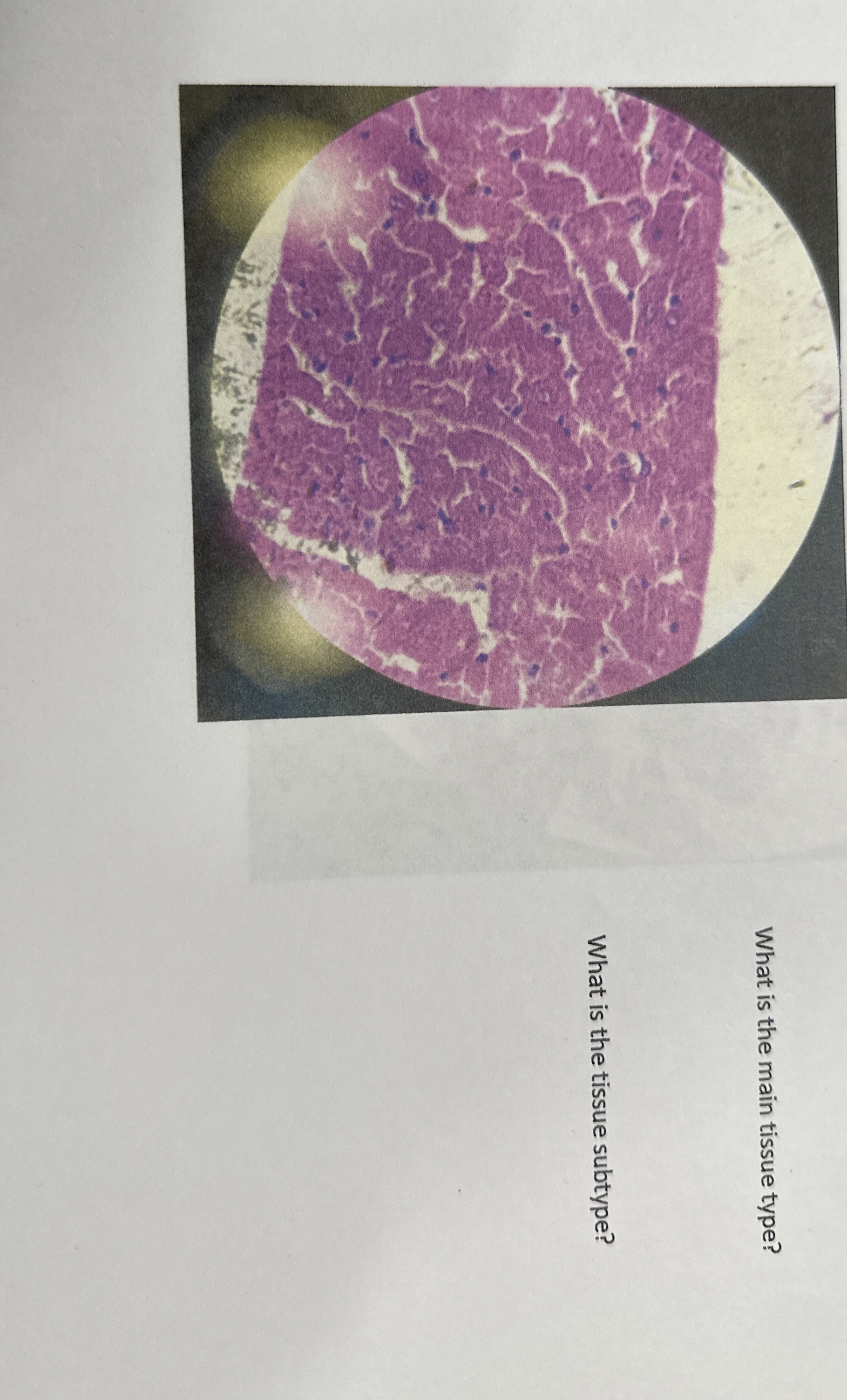 Solved What is the main tissue type?What is the tissue | Chegg.com