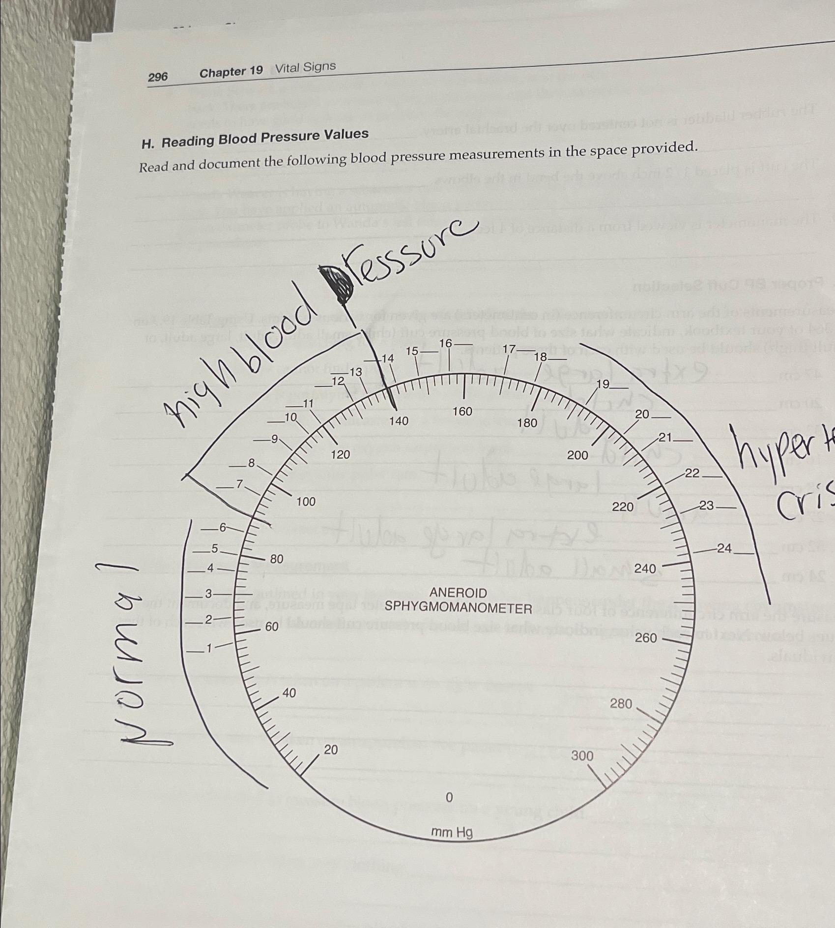 Solved 296Chapter 19 ﻿Vital SignsH. ﻿Reading Blood Pressure | Chegg.com