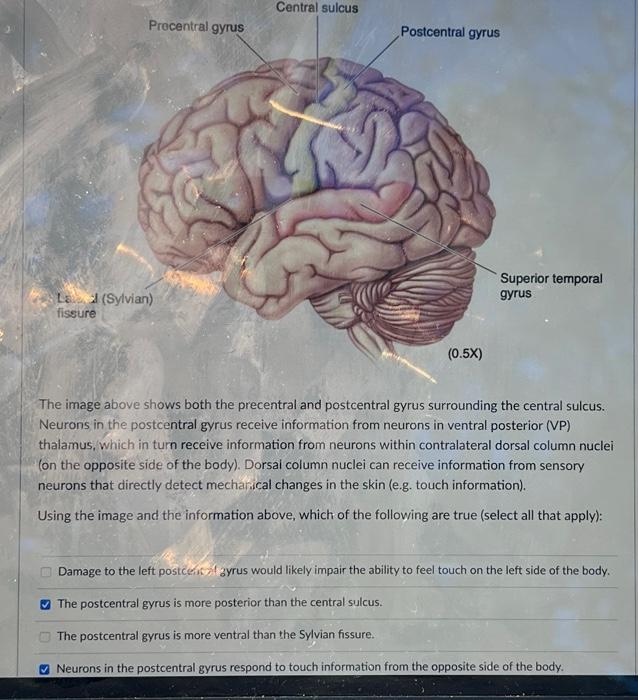 Solved The image above shows both the precentral and | Chegg.com