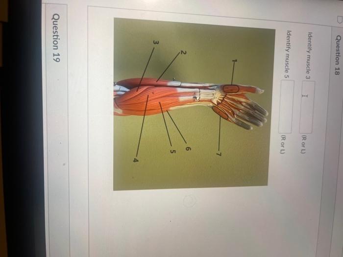 Solved Identify muscle 3 (R or 4) Identify muscle 5 (R or | Chegg.com Solved Identify muscle 3 (R or 4) Identify muscle 5 (R or | Chegg.com