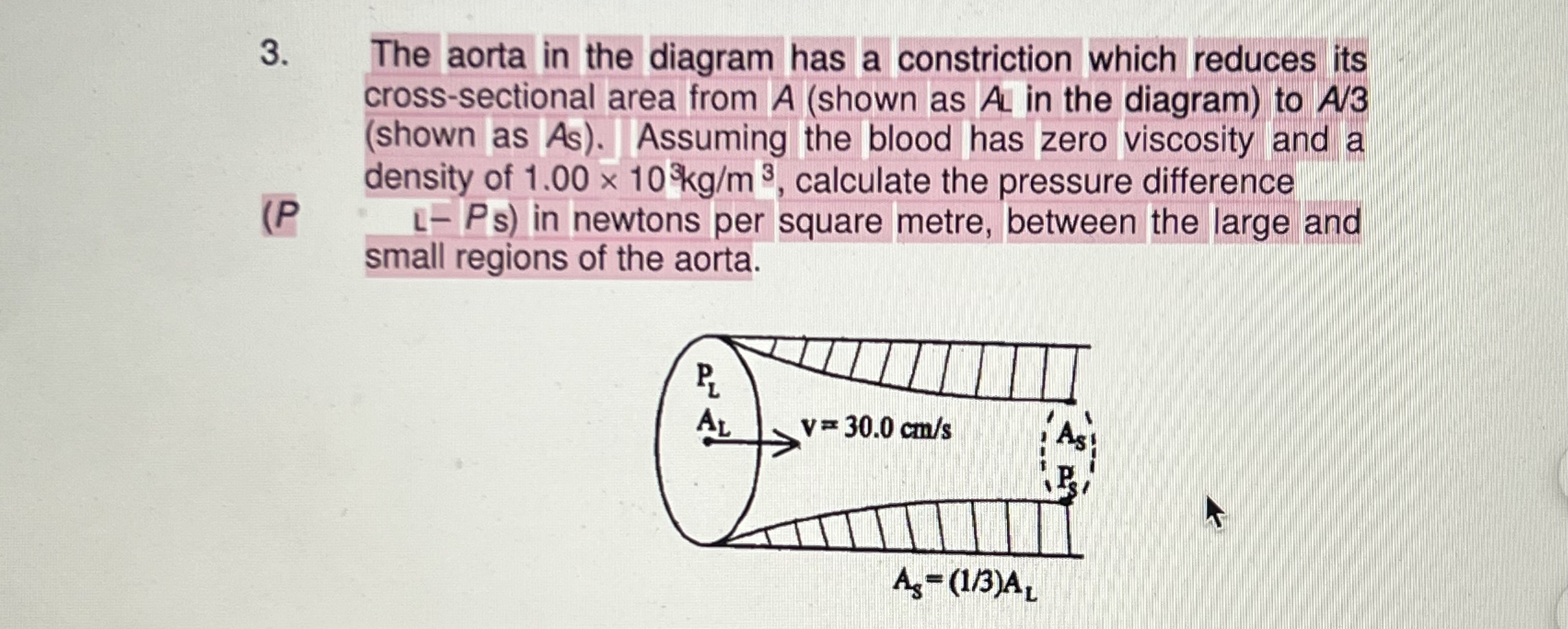 Solved The aorta in the diagram has a constriction which | Chegg.com