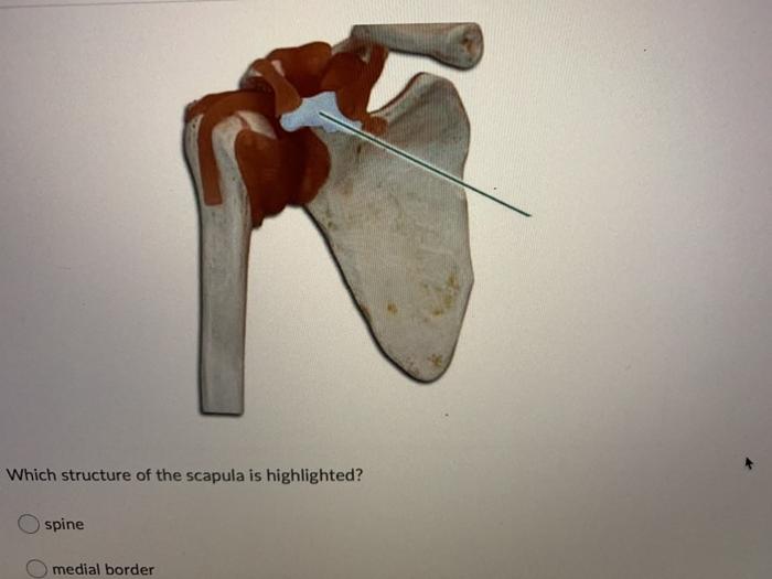 Solved Which structure of the scapula is highlighted? spine | Chegg.com
