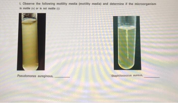Solved 1. Observe the following motility media (motility | Chegg.com