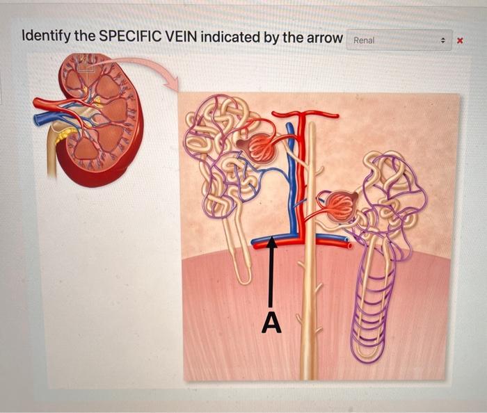 Solved Identify the SPECIFIC nephron structure indicated by | Chegg.com