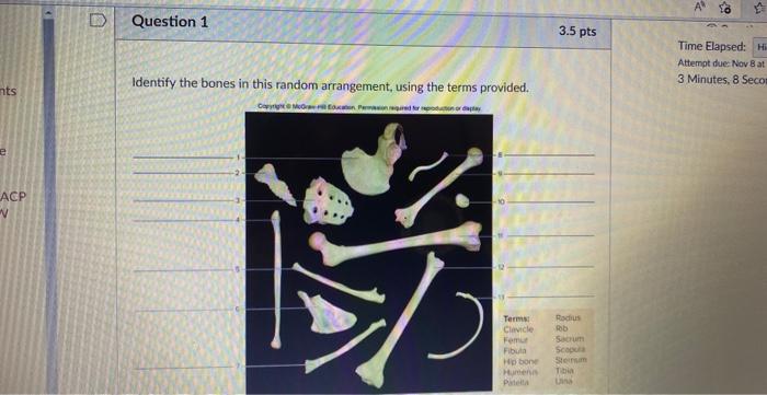 Solved Identify the bones in this random arrangement, using | Chegg.com