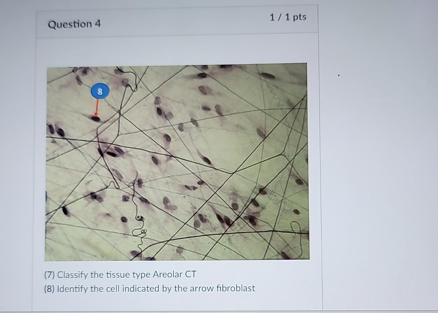 Solved (7) Classify the tissue type Areolar CT (8) Identify | Chegg.com