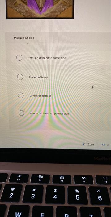 Solved What is the unilateral action of the | Chegg.com